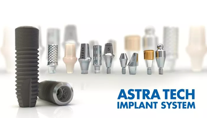 Astra Tech Implant - Types, Cost, Material & Benefits - Toothcaretips.com